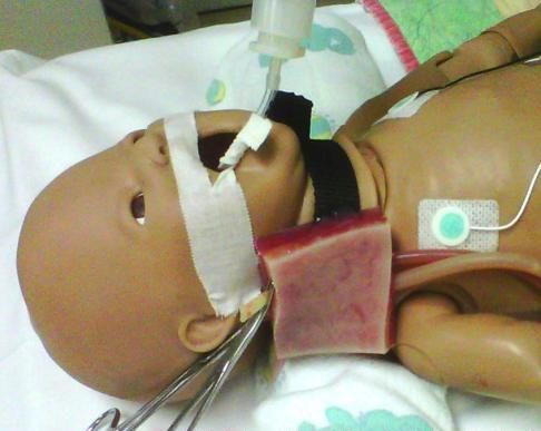 ECMO - Simulation Kit - 3-Dmed